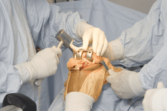 Orthopedic Vs. Bone Doctor-Who Should You See?
